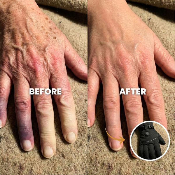 How These Gloves Helped Thousands Stop Suffering With Cold Numb Fingers ...